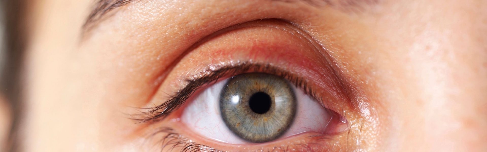 Do I Have Glaucoma Symptoms Know More About This Eye Disease